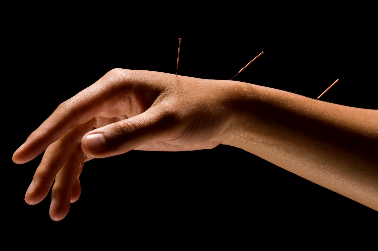 What is acupuncture? - Jill Owen Acupuncture